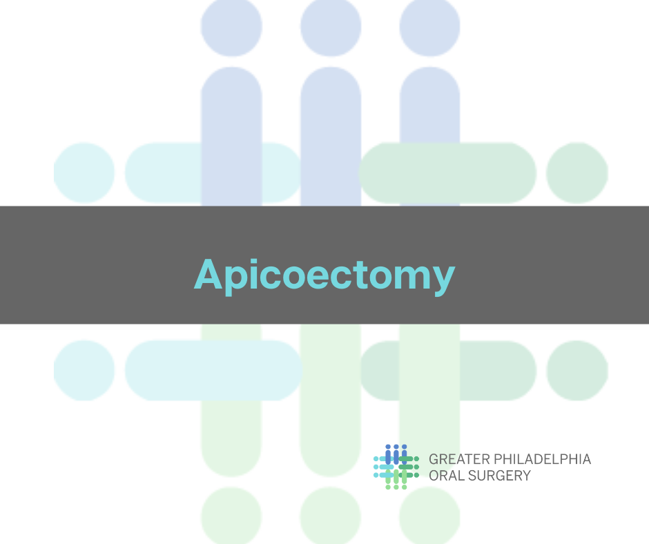Apicoectomy - Greater Philadelphia Oral Surgery